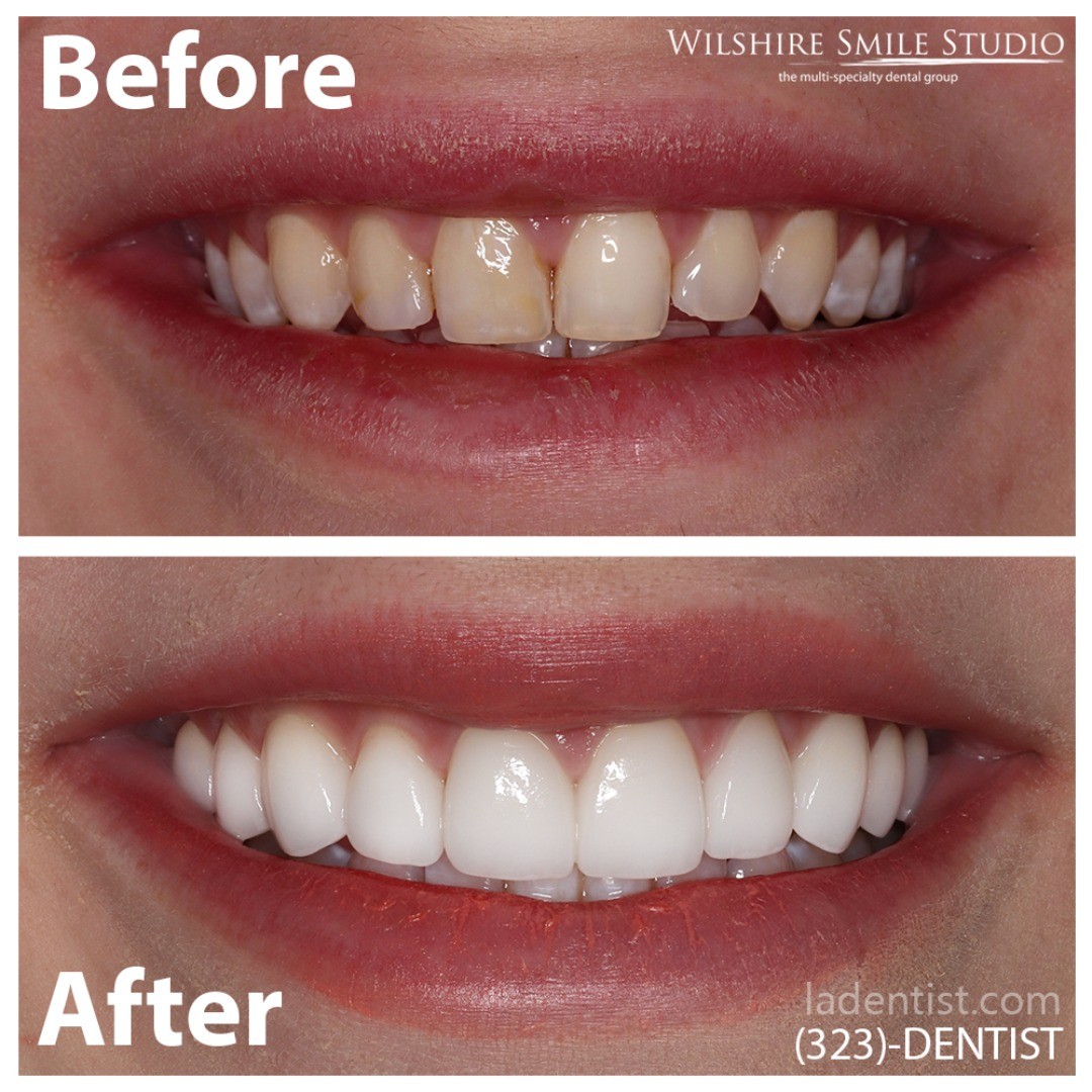 Smile Gallery | Wilshire Smile Studio